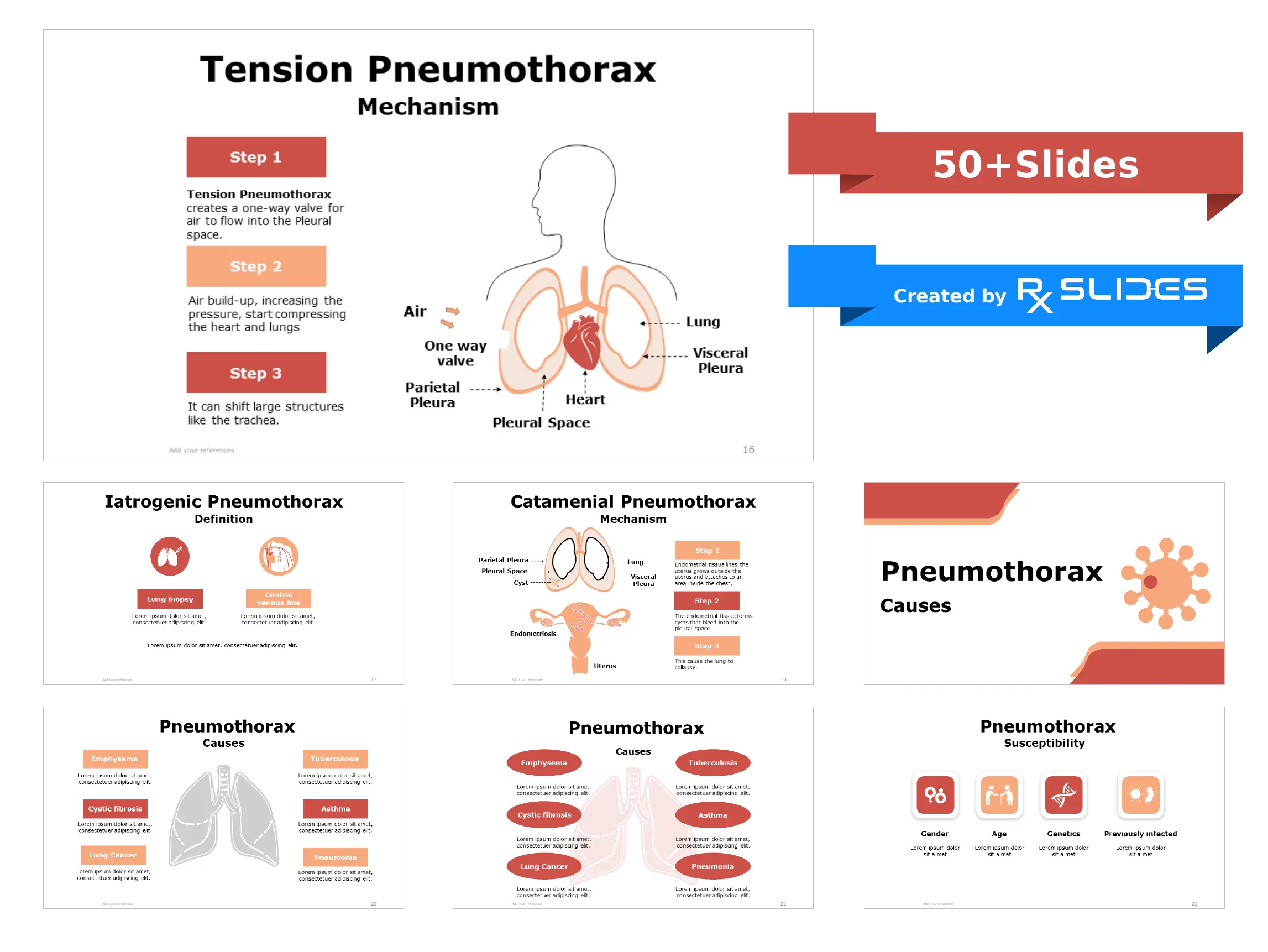 Download Pneumothorax PowerPoint Template|RxSlides